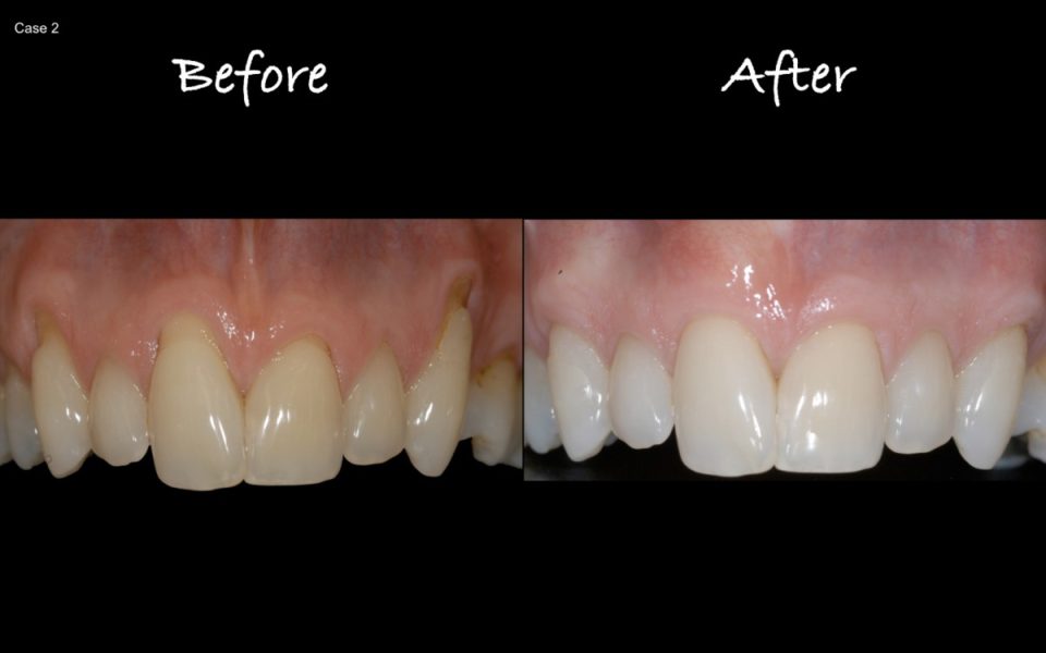 Periodontist in Woodland Hills, CA - Photo Gallery Brighton Periodontal ...